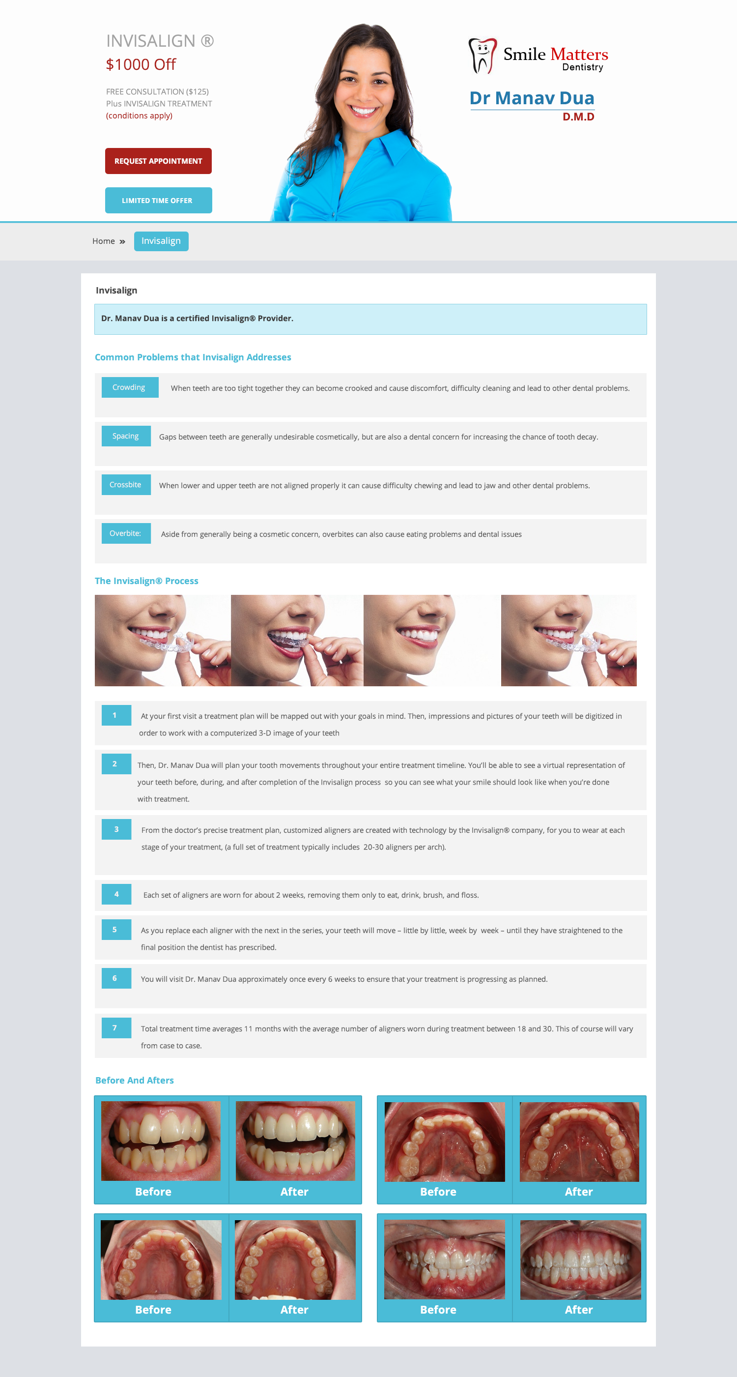 Special Offers - $1000 Off on Braces and Invisalign Braces | Smilematters